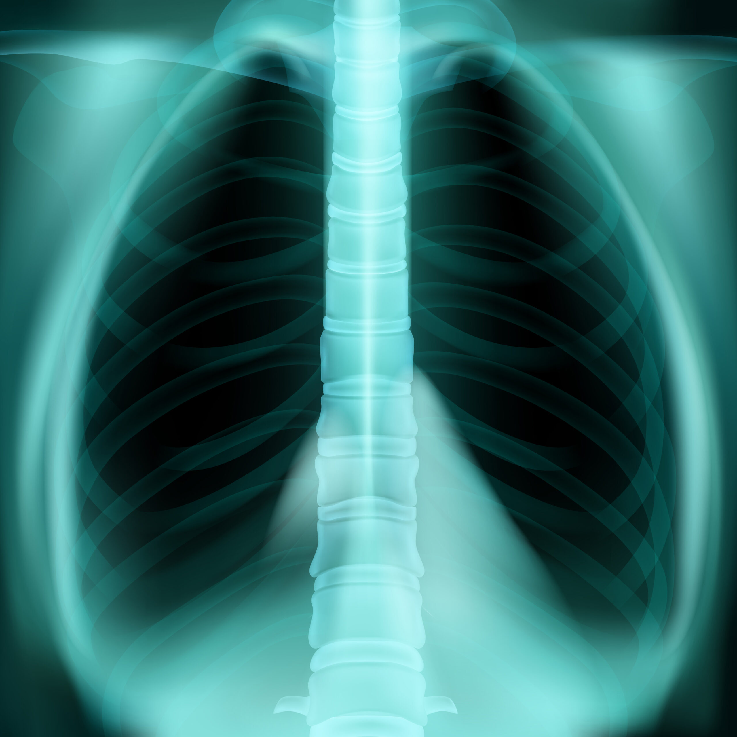 El arte de ver: signos icónicos en la imagen torácica – EIDOS